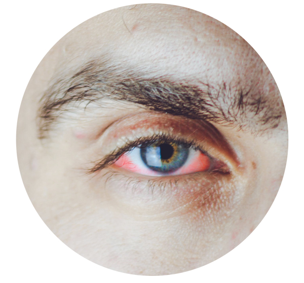 Prevent Arc Eye with AGO | OCS Academy Blog | ohcanadasupply.ca